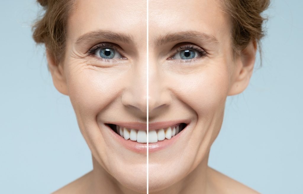 The Science Behind Combining Stem Cell and PRP Therapy for Optimal Skin ...