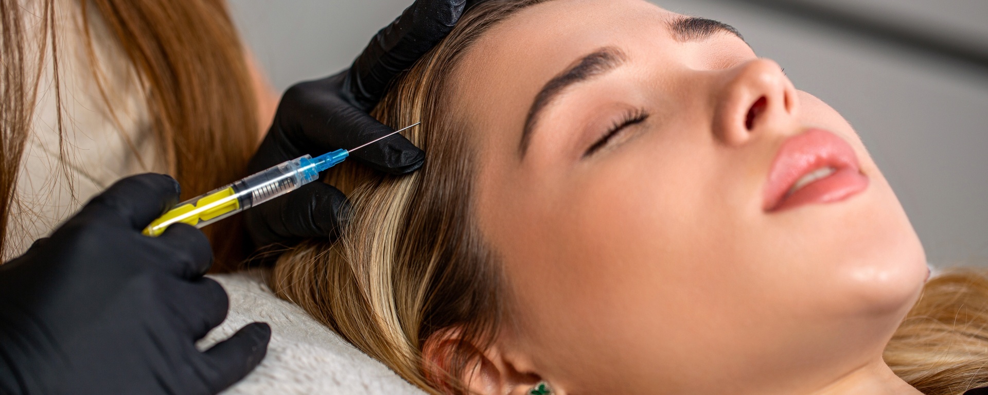 PRP/Stem Cell Hair Loss Treatment in Los Angeles | Beverly Hills